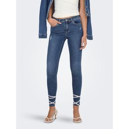Only Damen Only Skinny-fit-Jeans &raquo;ONLWAUW &ndash; Skinny-Jeans mit Destroyed-Effekt und Stretch&laquo; skinny fit, modisch, Denim, Baumwollmischung blau XS (34), 