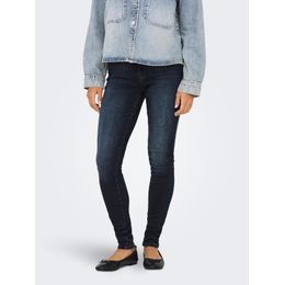 Skinny-fit-Jeans Only "ONLFOREVER HIGH HW SK DNM REA192", Damen, Gr. XS (34), L&auml;nge 30, blau (blau schwarz denim), Denim/Jeans, Obermaterial: 98% Baumwolle, 2% Elasthan, unifarben, skinny fit, Jeans