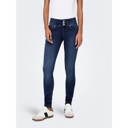 Only Damen Only Skinny-fit-Jeans &raquo;ONLROYAL REG VIS BUT SK DNM PIM&laquo; blau M (38), L&auml;nge 30