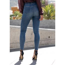 High-waist-Jeans Lascana, Damen, Gr. 34, N-Gr, blau (blau, washed), Denim/Jeans, Obermaterial: 98% Baumwolle, 2% Elasthan, figurbetont kn&ouml;chellang, Jeans High-Waist-Jeans, mit sichtbarer Knopfleiste und Stretch-Anteil, Skinny, High Waist