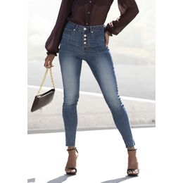 High-waist-Jeans Lascana, Damen, Gr. 34, N-Gr, blau (blau, washed), Denim/Jeans, Obermaterial: 98% Baumwolle, 2% Elasthan, figurbetont kn&ouml;chellang, Jeans High-Waist-Jeans, mit sichtbarer Knopfleiste und Stretch-Anteil, Skinny, High Waist