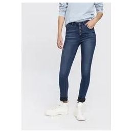 Skinny-fit-Jeans Arizona "Ultra Stretch", Damen, Gr. 36, N-Gr, blau (dunkelblau us), Denim/Jeans, Obermaterial: 63% Baumwolle, 32% Polyester, 5% Elasthan, skinny fit kn&ouml;chellang, Jeans, extra-enger Beinschnitt, hohe Leibh&ouml;he, kn&ouml;chellang