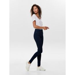 Only Damen Only Skinny-fit-Jeans &raquo;ONLROYAL HIGH SKINNY JEANS 101&laquo; blau XS (34), L&auml;nge 30