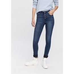 Skinny-fit-Jeans Arizona "Ultra Stretch", Damen, Gr. 34, N-Gr, blau (dunkelblau us), Denim/Jeans, Obermaterial: 63% Baumwolle, 32% Polyester, 5% Elasthan, skinny fit kn&ouml;chellang, Jeans Skinny-fit-Jeans, extra-enger Beinschnitt, hohe Leibh&ouml;he, kn&ouml;chellang