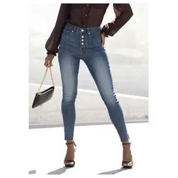 High-waist-Jeans Lascana, Damen, Gr. 34, N-Gr, blau (blau, washed), Denim/Jeans, Obermaterial: 98% Baumwolle, 2% Elasthan, figurbetont kn&ouml;chellang, Jeans High-Waist-Jeans, mit sichtbarer Knopfleiste und Stretch-Anteil, Skinny, High Waist
