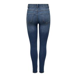 Only Jeans 'ONLRose' Damen Gr&ouml;&szlig;e 34 blue denim
