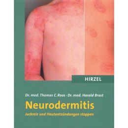 Neurodermitis