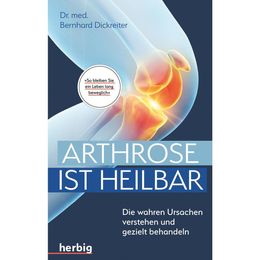 Arthrose ist heilbar