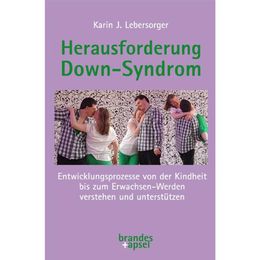 Herausforderung Down-Syndrom