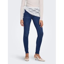 High-waist-Jeans Only "ONLROYAL", Damen, Gr. S (36), L&auml;nge 30, blau (dunkelblau denim), Denim/Jeans, Obermaterial: 69% Baumwolle, 29% Polyester, 2% Elasthan, unifarben, Jeans High-waist-Jeans