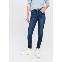 Skinny-fit-Jeans Arizona "Ultra Stretch", Damen, Gr. 34, N-Gr, blau (dunkelblau us), Denim/Jeans, Obermaterial: 63% Baumwolle, 32% Polyester, 5% Elasthan, skinny fit kn&ouml;chellang, Jeans, extra-enger Beinschnitt, hohe Leibh&ouml;he, kn&ouml;chellang