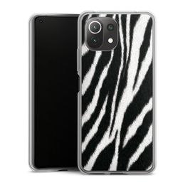 DeinDesign Xiaomi Mi 11 Lite 5G NE Handy Silikon H&uuml;lle Case transparent Handyh&uuml;lle Fur Muster Zebra Silikon Case
