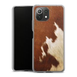 DeinDesign Xiaomi Mi 11 Lite 5G NE Handy Silikon H&uuml;lle Case transparent Handyh&uuml;lle Fur Cow Animal Look Silikon Case