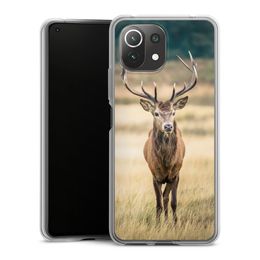 DeinDesign Xiaomi Mi 11 Lite 5G NE Handy Silikon H&uuml;lle Case transparent Handyh&uuml;lle Forrest Meadow Deer Silikon Case