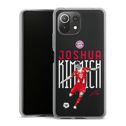 DeinDesign Xiaomi Mi 11 Lite 5G NE Handy Silikon H&uuml;lle Case transparent Handyh&uuml;lle Fc Bayern M&uuml;nchen Official Licensed Product Kimmich Silikon Case