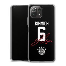 DeinDesign Xiaomi Mi 11 Lite 5G NE Handy Silikon H&uuml;lle Case transparent Handyh&uuml;lle Fcb Fc Bayern M&uuml;nchen Kimmich Silikon Case