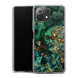 DeinDesign Xiaomi Mi 11 Lite 5G NE Handy Silikon H&uuml;lle Case transparent Handyh&uuml;lle Muster Glitzer Marble Silikon Case