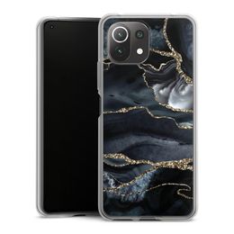 DeinDesign Xiaomi Mi 11 Lite 5G NE Handy Silikon H&uuml;lle Case transparent Handyh&uuml;lle Trends Glitzer Marble Silikon Case