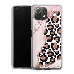 DeinDesign Xiaomi Mi 11 Lite 5G NE Handy Silikon H&uuml;lle Case transparent Handyh&uuml;lle Leopard Glitzer Marble Silikon Case