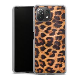 DeinDesign Xiaomi Mi 11 Lite 5G NE Handy Silikon H&uuml;lle Case transparent Handyh&uuml;lle Animal Print Leopard Fur Silikon Case