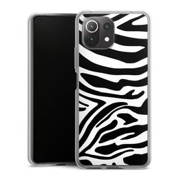 DeinDesign Xiaomi Mi 11 Lite 5G NE Handy Silikon H&uuml;lle Case transparent Handyh&uuml;lle Animal Look Zebra Animal Print Silikon Case