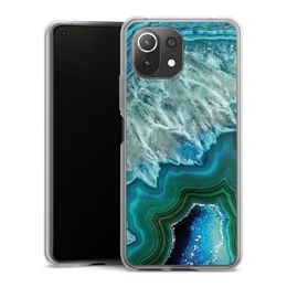 DeinDesign Xiaomi Mi 11 Lite 5G NE Handy Silikon H&uuml;lle Case transparent Handyh&uuml;lle Stone Marble Blue Silikon Case