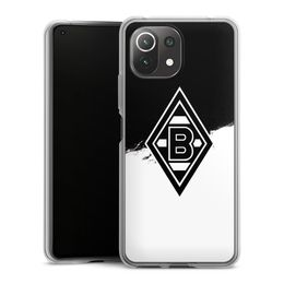 DeinDesign Xiaomi Mi 11 Lite 5G NE Handy Silikon H&uuml;lle Case transparent Handyh&uuml;lle Bmg Borussia M&ouml;nchengladbach Gladbach Silikon Case