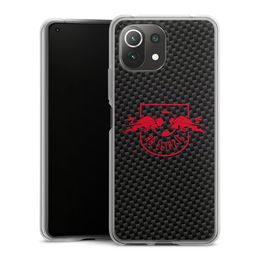 DeinDesign Xiaomi Mi 11 Lite 5G NE Handy Silikon H&uuml;lle Case transparent Handyh&uuml;lle Rb Leipzig Official Licensed Product Carbon Silikon Case