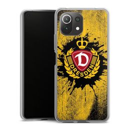 DeinDesign Xiaomi Mi 11 Lite 5G NE Handy Silikon H&uuml;lle Case transparent Handyh&uuml;lle Official Licensed Product Soccer Sg Dynamo Dresden Silikon Case