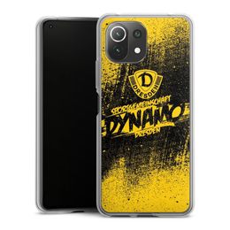 DeinDesign Xiaomi Mi 11 Lite 5G NE Handy Silikon H&uuml;lle Case transparent Handyh&uuml;lle Official Licensed Product Sg Dynamo Dresden Logo Silikon Case