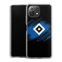 DeinDesign Xiaomi Mi 11 Lite 5G NE Handy Silikon H&uuml;lle Case transparent Handyh&uuml;lle Official Licensed Product Hsv Hamburger Sv Silikon Case