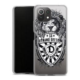 DeinDesign Xiaomi Mi 11 Lite 5G NE Handy Silikon H&uuml;lle Case transparent Handyh&uuml;lle Lion Sgd Sg Dynamo Dresden Silikon Case