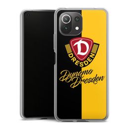 DeinDesign Xiaomi Mi 11 Lite 5G NE Handy Silikon H&uuml;lle Case transparent Handyh&uuml;lle Sg Dynamo Dresden Sgd Official Licensed Product Silikon Case