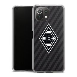 DeinDesign Xiaomi Mi 11 Lite 5G NE Handy Silikon H&uuml;lle Case transparent Handyh&uuml;lle Gladbach Carbon Borussia M&ouml;nchengladbach Silikon Case