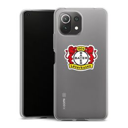DeinDesign Xiaomi Mi 11 Lite 5G NE Handy Silikon H&uuml;lle Case transparent Handyh&uuml;lle Official Licensed Product Bayer 04 Leverkusen Logo Silikon Case