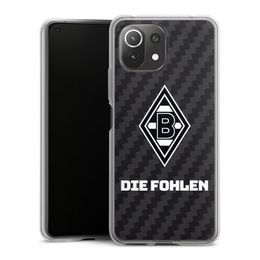 DeinDesign Xiaomi Mi 11 Lite 5G NE Handy Silikon H&uuml;lle Case transparent Handyh&uuml;lle Carbon Borussia M&ouml;nchengladbach Gladbach Silikon Case