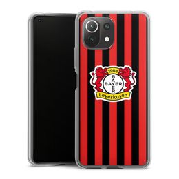 DeinDesign Xiaomi Mi 11 Lite 5G NE Handy Silikon H&uuml;lle Case transparent Handyh&uuml;lle Stripes Bayer 04 Leverkusen Official Licensed Product Silikon Case
