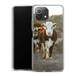 DeinDesign Xiaomi Mi 11 Lite 5G NE Handy Silikon H&uuml;lle Case transparent Handyh&uuml;lle Farmer Calf Cow Silikon Case