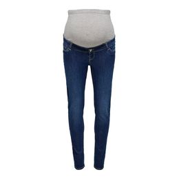 Only Skinny Jeans in Dark Blue Denim | Gr.: L/L32