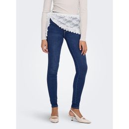 Only Damen Only High-waist-Jeans &raquo;ONLROYAL&laquo; blau S (36), L&auml;nge 34