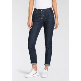 Please Jeans Damen 5-Pocket-Jeans Sichtbare Knopfleiste blau XS (34), N-Gr