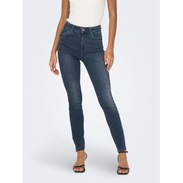Only Damen High-waist-Jeans "ONLMILA HW SK ANK DNM BJ407", blau, Gr. 25, Abriebeffekte, Denim/Jeans, Obermaterial: 94% Baumwolle, 4% Polyester, 2%