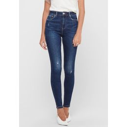 Only Damen High-waist-Jeans "ONLMILA HW SK ANK BJ374 NOOS", blau, Gr. 25, Abriebeffekte, Denim/Jeans, Obermaterial: 94% Baumwolle, 4% Polyester, 2%